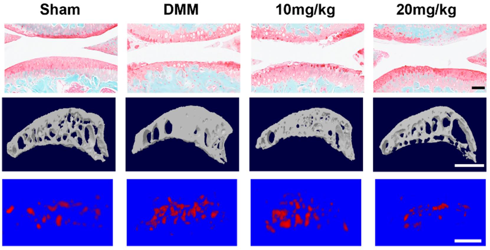 我院苏佳灿教授团队在生物学一区期刊《Cell Proliferation》上发表了关于内皮细胞Stat3调控OA的研究文章-上海大学转化医学研究院